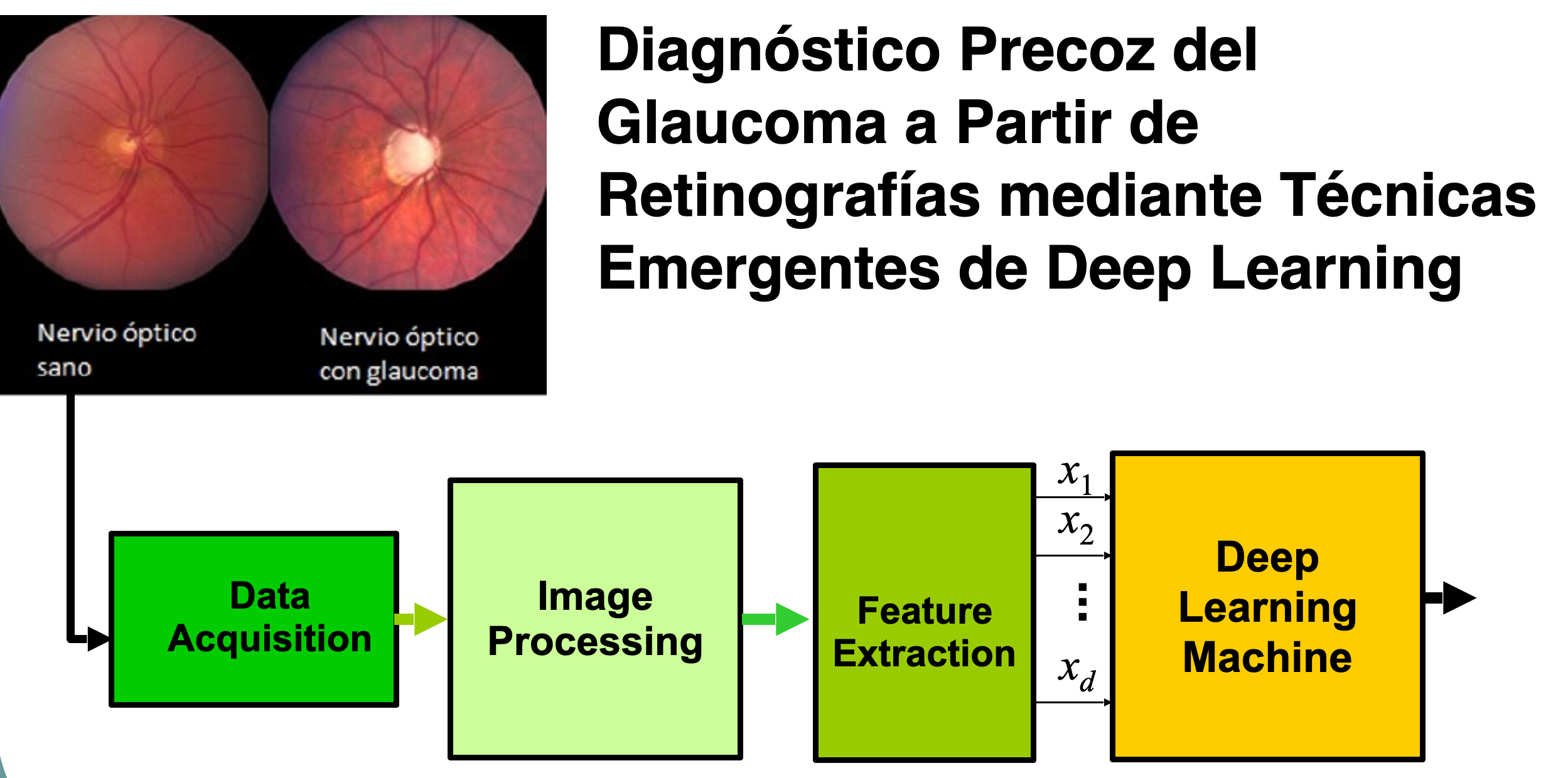 'Deep learning' para la detección precoz del glaucoma | Fundación Seneca 'Deep learning' para la detección precoz del glaucoma | Fundación Seneca